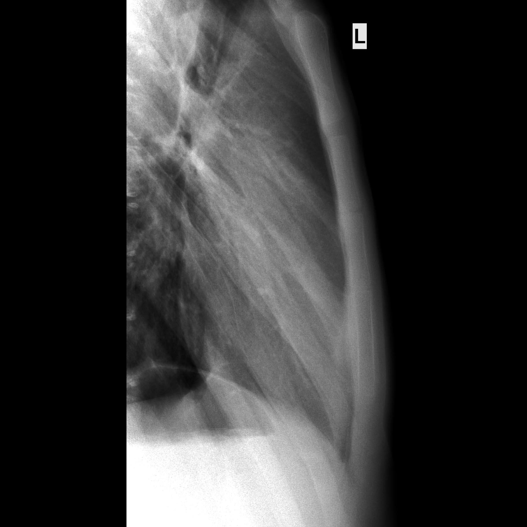 Bild 2/4 - Röntgen: Sternum seitlich
