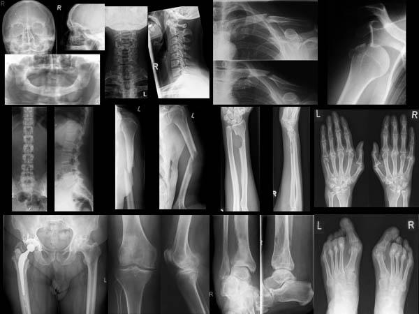 © Institut für Diagnostische, Interventionelle und Pädiatrische ...