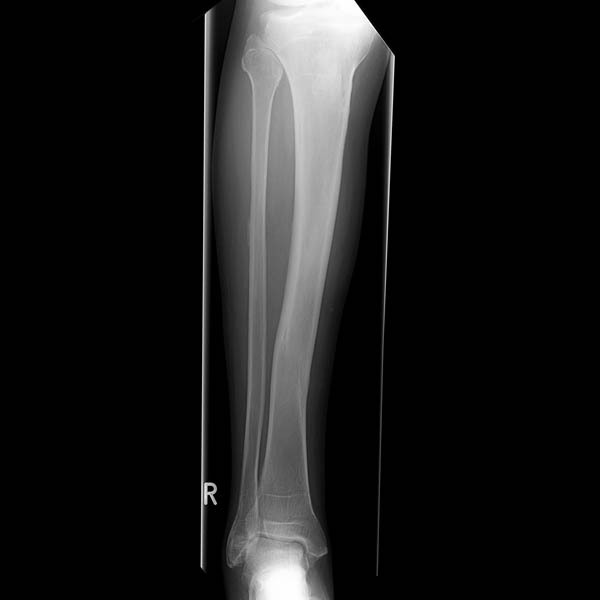 © Institut für Diagnostische, Interventionelle und Pädiatrische ...
