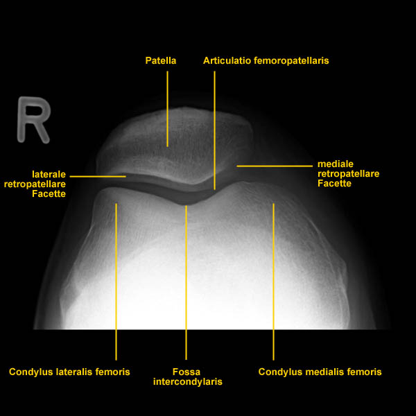 © Institut für Diagnostische, Interventionelle und Pädiatrische ...