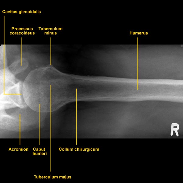 Bild 2/8 - Röntgen: Schulter axial im Sitzen