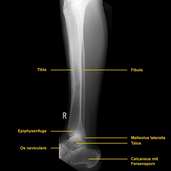 © Institut für Diagnostische, Interventionelle und Pädiatrische ...