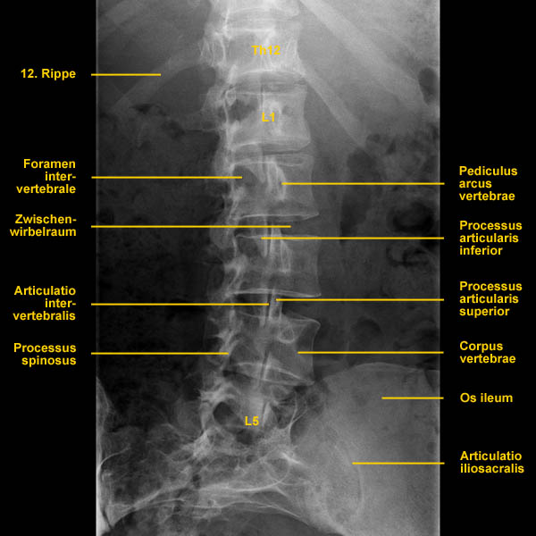 Bild 3/4 - Röntgen: LWS schräg