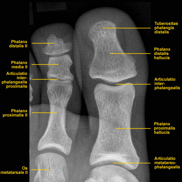© Institut für Diagnostische, Interventionelle und Pädiatrische ...