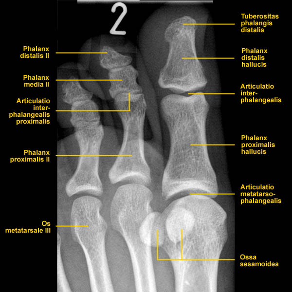 © Institut für Diagnostische, Interventionelle und Pädiatrische Radiologie, Inselspital Bern