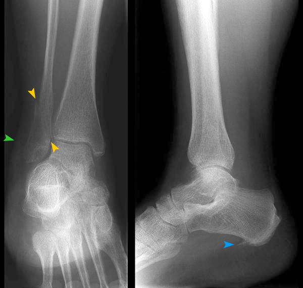 © Institut für Diagnostische, Interventionelle und Pädiatrische ...