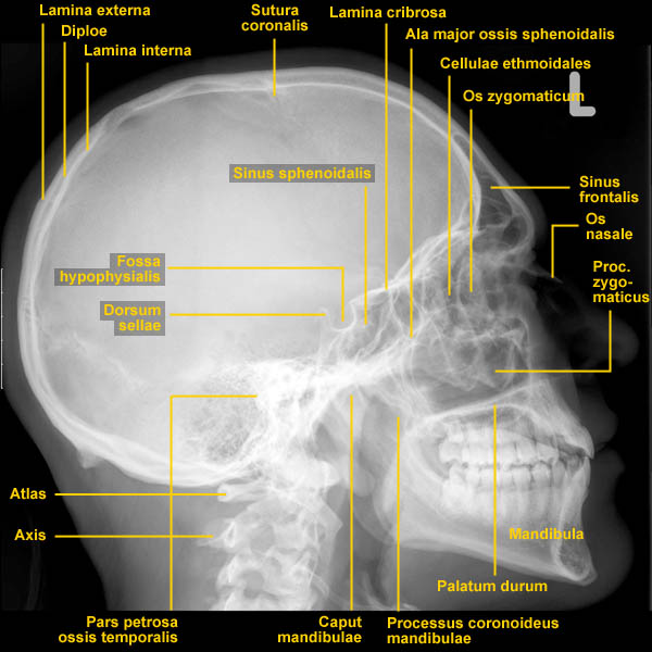 Bild 2/11 - Röntgen: Schädel seitlich