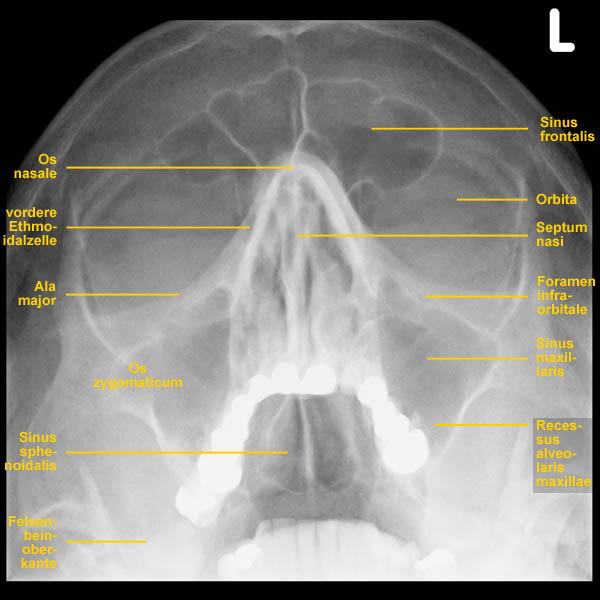 © Institut für Diagnostische, Interventionelle und Pädiatrische ...