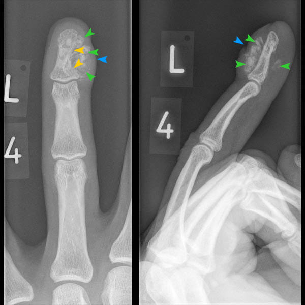 © Institut für Diagnostische, Interventionelle und Pädiatrische ...