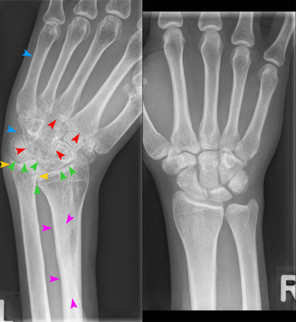 © Institut für Diagnostische, Interventionelle und Pädiatrische ...