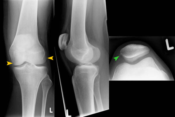 Vergleich mit Normalbefund