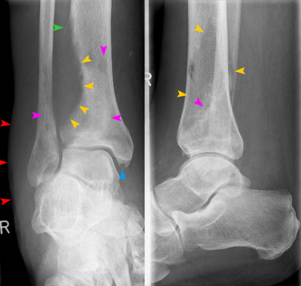 © Institut für Diagnostische, Interventionelle und Pädiatrische ...