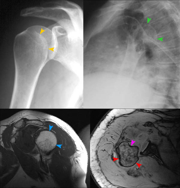 © Institut für Diagnostische Radiologie, UniversitätsSpital Zürich