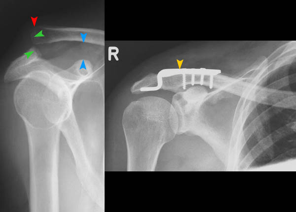 © Institut für Diagnostische Radiologie, UniversitätsSpital Zürich
