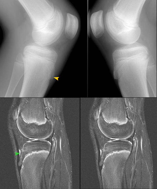 © Institut für Diagnostische Radiologie, UniversitätsSpital Zürich