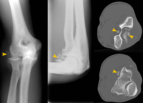 © Institut für Diagnostische Radiologie, UniversitätsSpital Zürich
