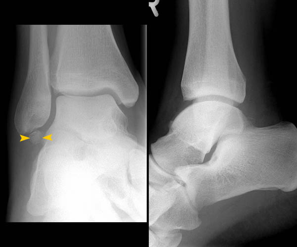 © Institut für Diagnostische Radiologie, UniversitätsSpital Zürich