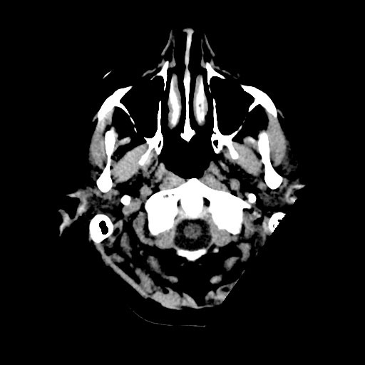 © Radiologische Universitätsklink, Universitätsklinikum Freiburg