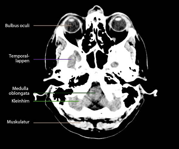 © Radiologische Universitätsklink, Universitätsklinikum Freiburg