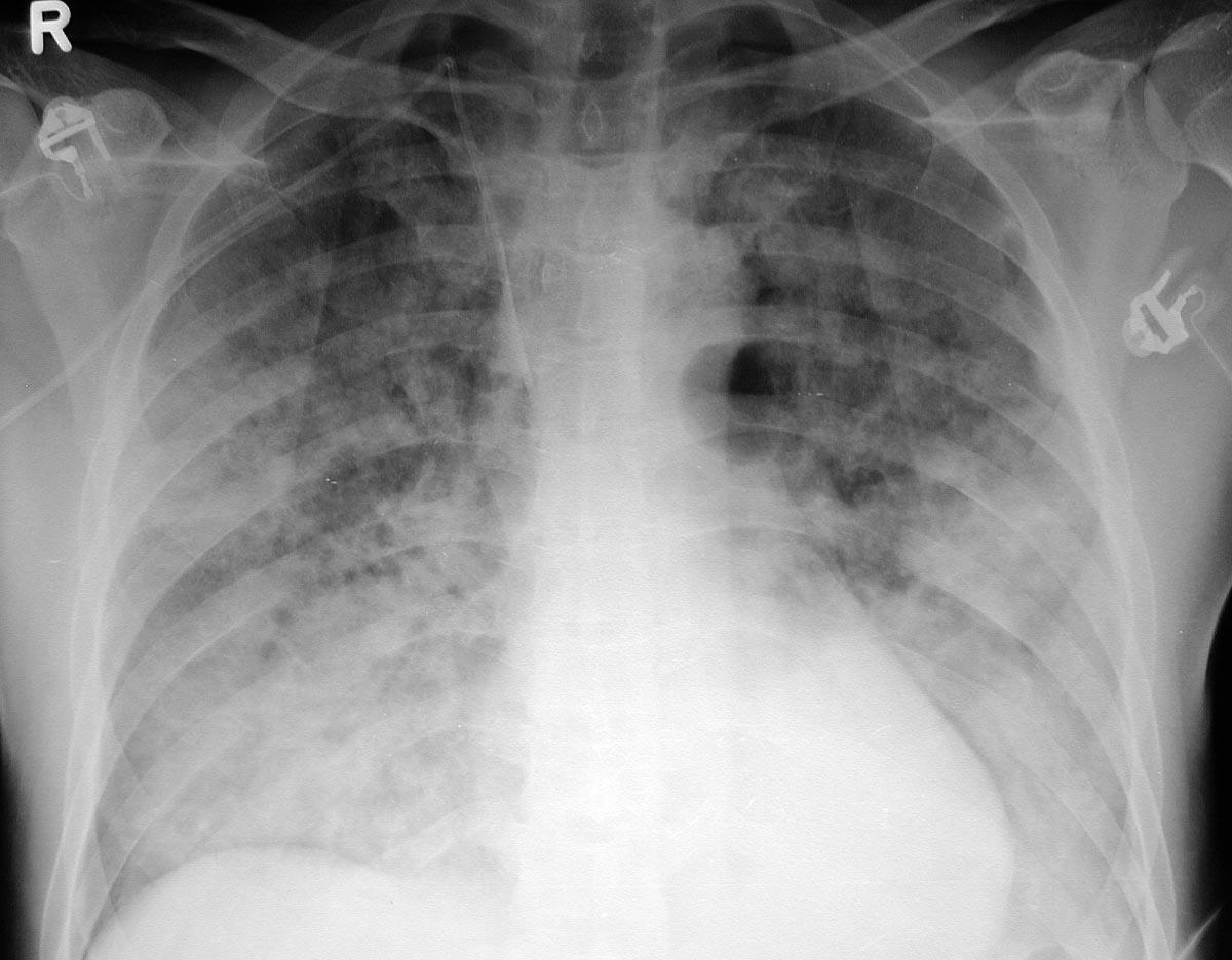 Innervation Thorax Abdomen Und Becke Eref Thieme