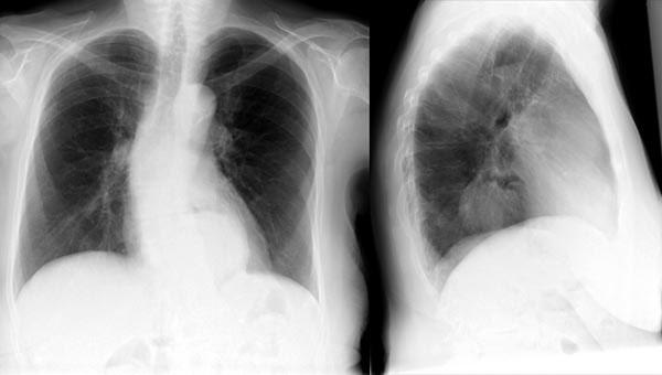 © Institut für Diagnostische, Interventionelle und Pädiatrische ...