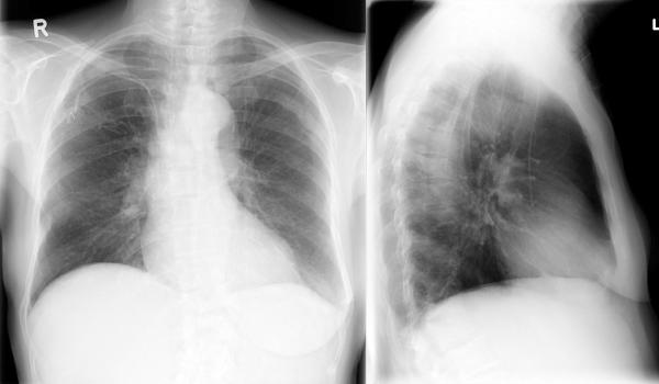 © Institut für Diagnostische, Interventionelle und Pädiatrische ...