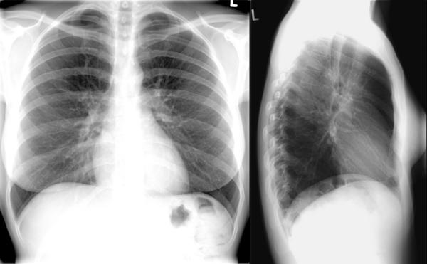 © Institut für Diagnostische, Interventionelle und Pädiatrische ...