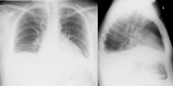 © Institut für Diagnostische, Interventionelle und Pädiatrische ...