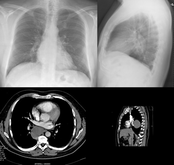 Thoraxröntgen Skelettröntgen Schädel-CT Abk. Hilfe Sitemap