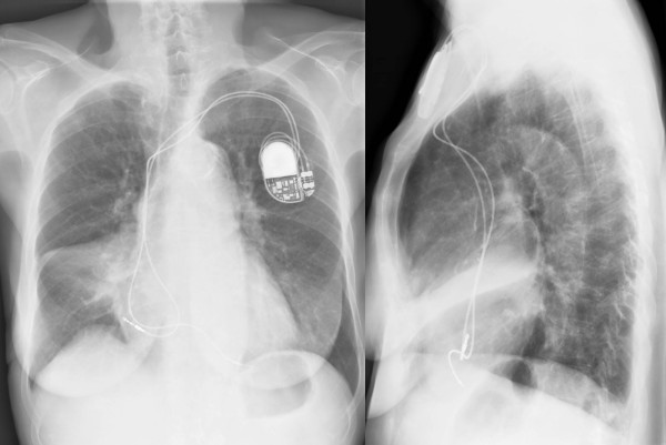 Thoraxröntgen Skelettröntgen Schädel-CT Abk. Hilfe Sitemap