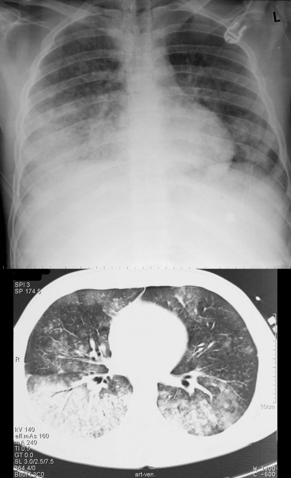 Thoraxröntgen Skelettröntgen Schädel-CT Abk. Hilfe Sitemap