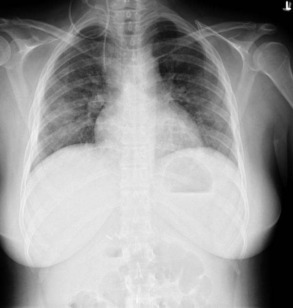 nach der konventionellen aufnahme eindeutige veränderungen welche im ...