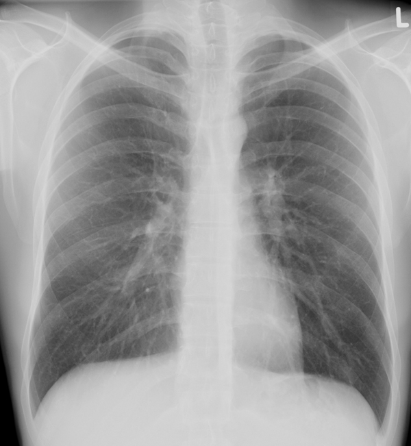 p img src stats iml unibe ch matomo php idsite 18 amp rec 1 style ...