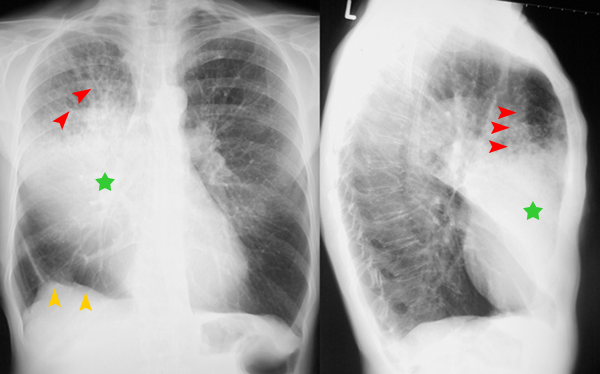 © Institut für Diagnostische, Interventionelle und Pädiatrische ...