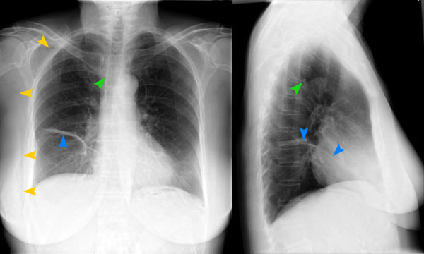 © Institut für Diagnostische, Interventionelle und Pädiatrische ...