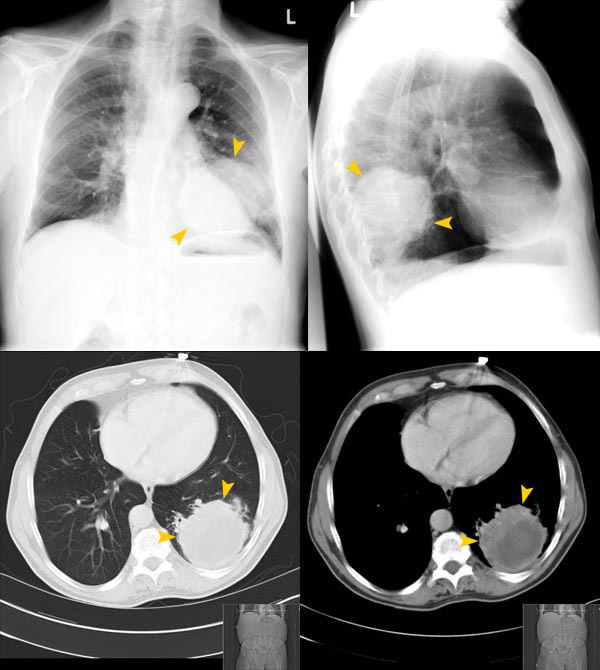 © Institut für Diagnostische, Interventionelle und Pädiatrische ...