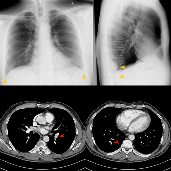 © Institut für Diagnostische, Interventionelle und Pädiatrische ...
