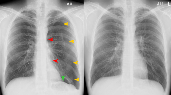 © Institut für Diagnostische, Interventionelle und Pädiatrische ...