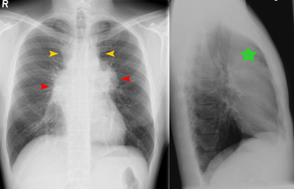 © Institut für Diagnostische, Interventionelle und Pädiatrische ...