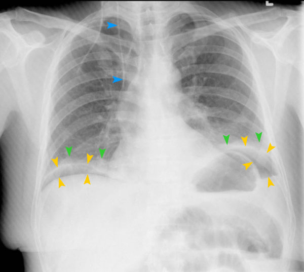 © Institut für Diagnostische Radiologie, UniversitätsSpital Zürich