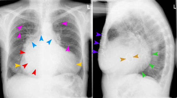 © Institut für Diagnostische Radiologie, UniversitätsSpital Zürich