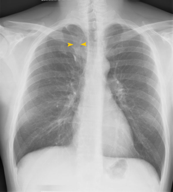 © Institut für Diagnostische Radiologie, UniversitätsSpital Zürich