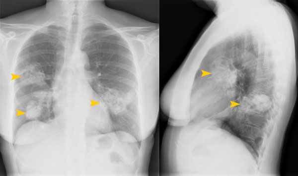 © Institut für Diagnostische Radiologie, UniversitätsSpital Zürich
