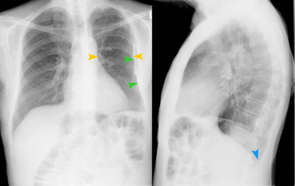 © Institut für Diagnostische Radiologie, UniversitätsSpital Zürich