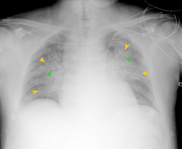 © Institut für Diagnostische Radiologie, UniversitätsSpital Zürich