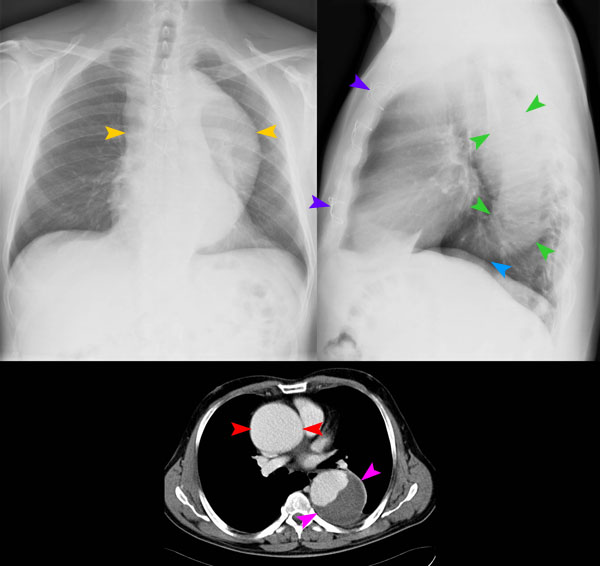 © Institut für Diagnostische Radiologie, UniversitätsSpital Zürich