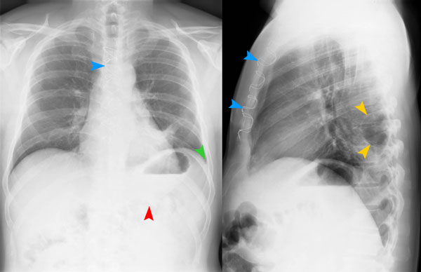 © Institut für Diagnostische Radiologie, UniversitätsSpital Zürich