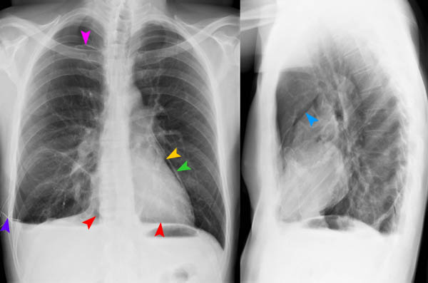 © Institut für Diagnostische Radiologie, UniversitätsSpital Zürich