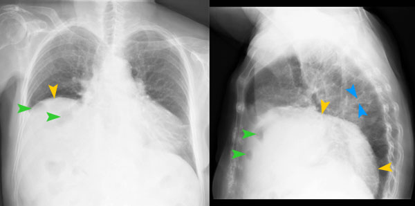 institut für diagnostische radiologie universitätsspital zürich