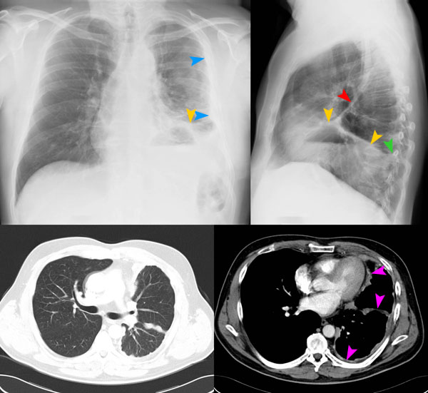 institut für diagnostische radiologie universitätsspital zürich